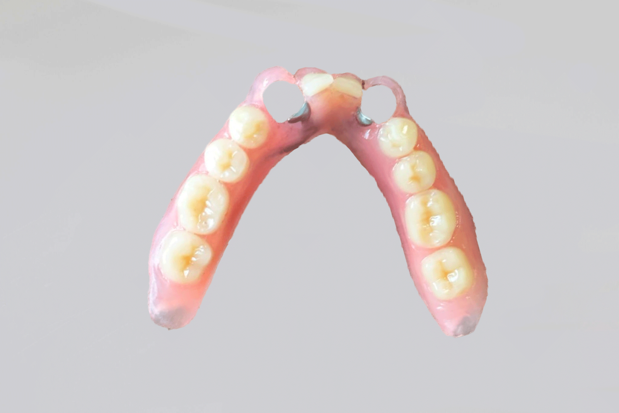 Prothèses Adjointes - DENTAL GALLERY