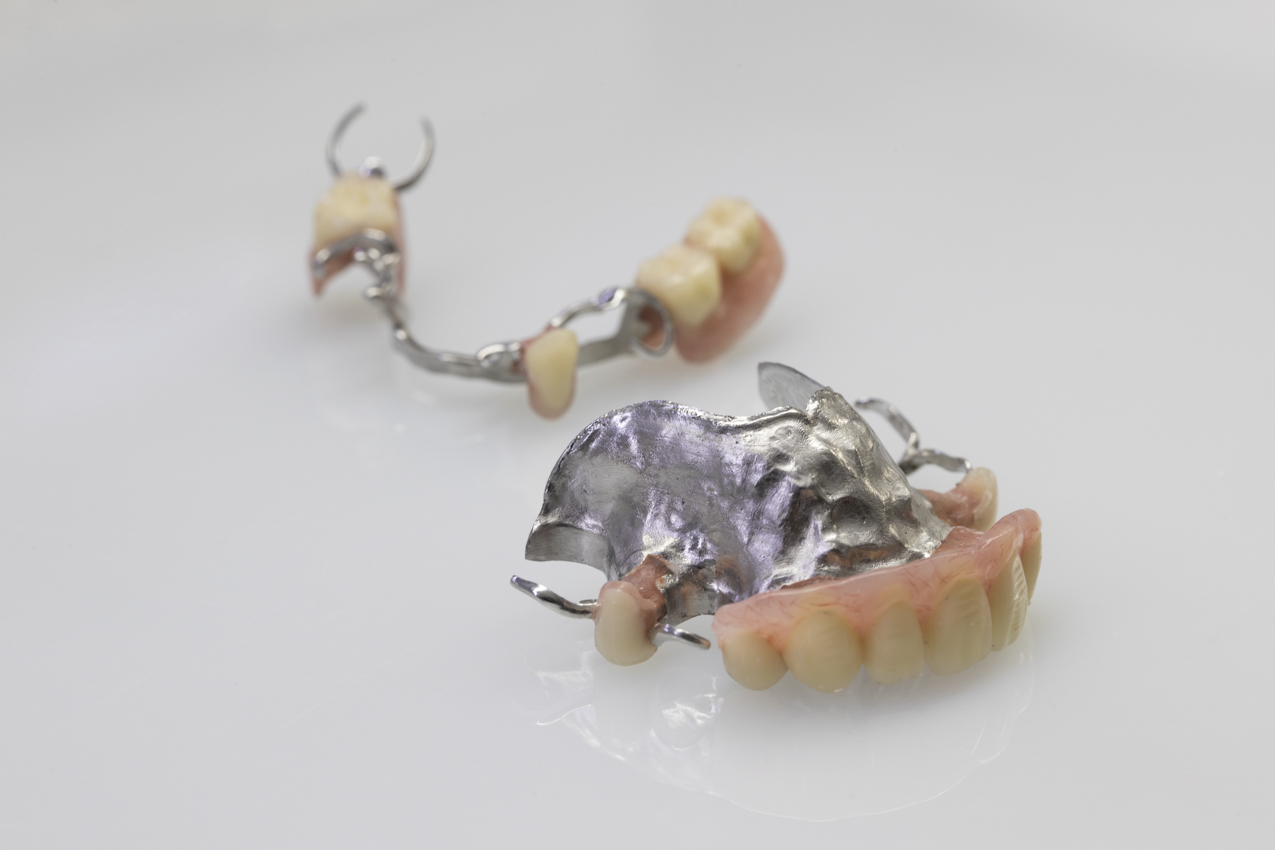 Prothèses Adjointes - DENTAL GALLERY