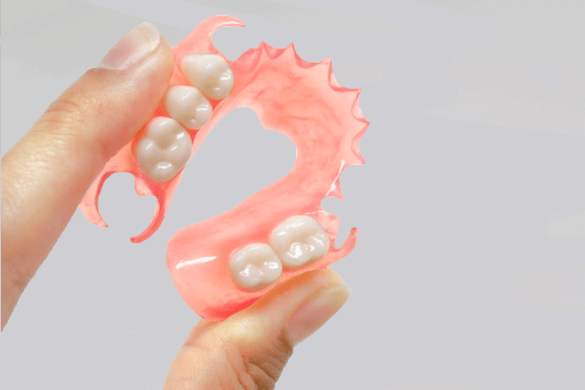 Prothèses Adjointes - DENTAL GALLERY