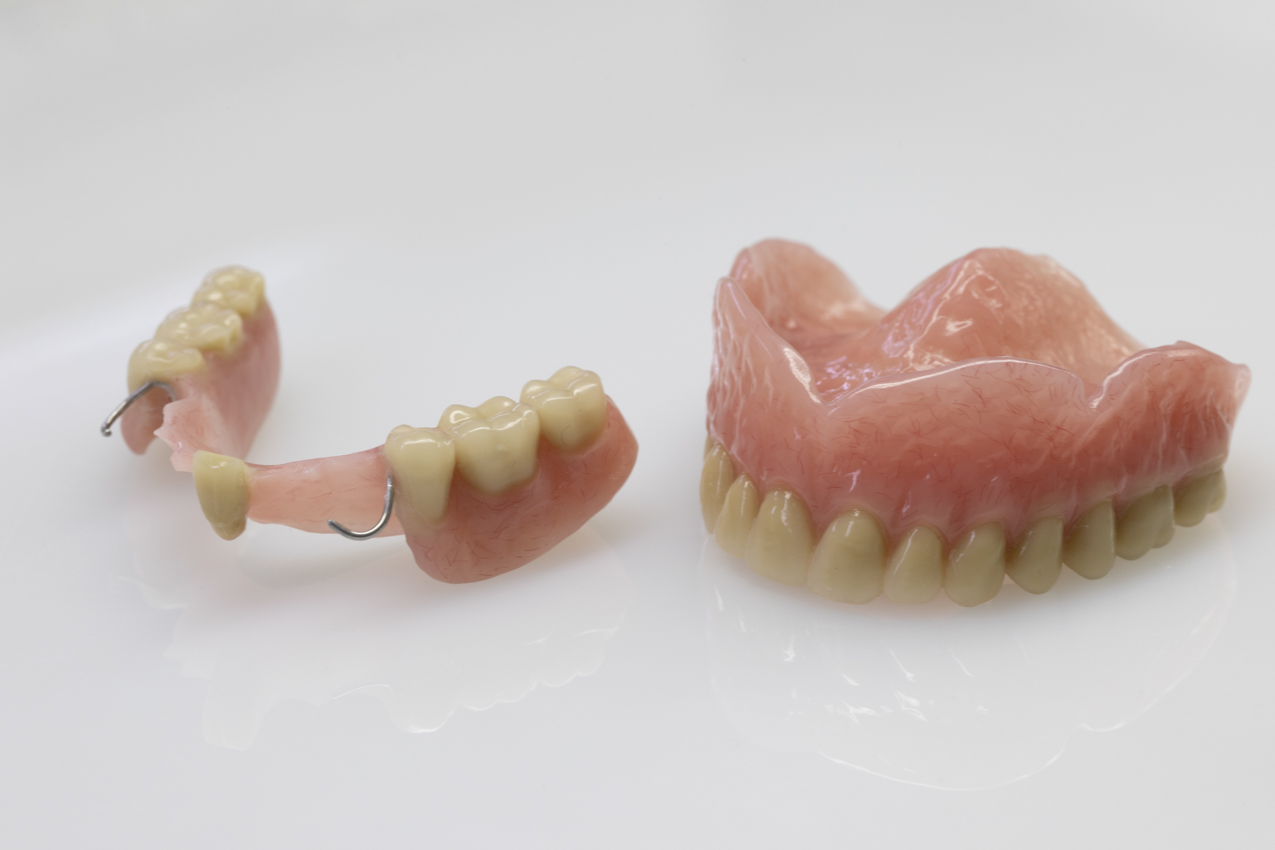 Prothèses Adjointes - DENTAL GALLERY