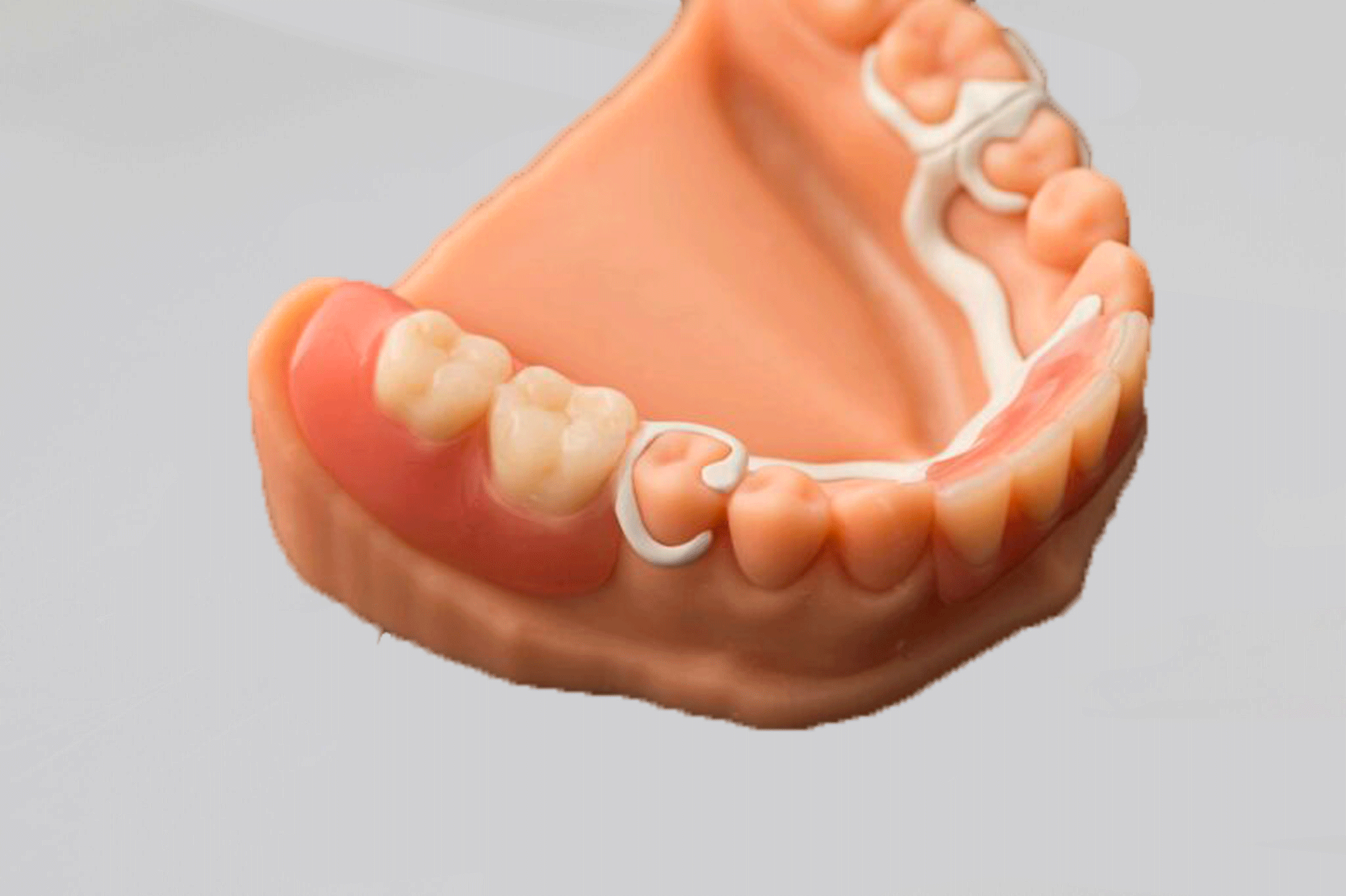 Prothèses Adjointes - DENTAL GALLERY