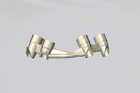 Prothèses Implantaires - DENTAL GALLERY